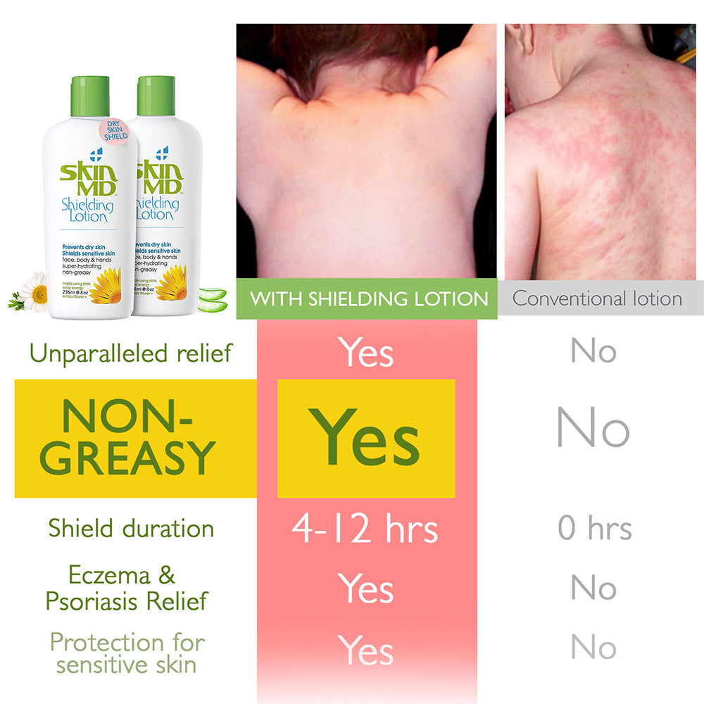 Skin MD Shielding Lotion 8oz (2 Pack) with Pump – SkinMD Online Store